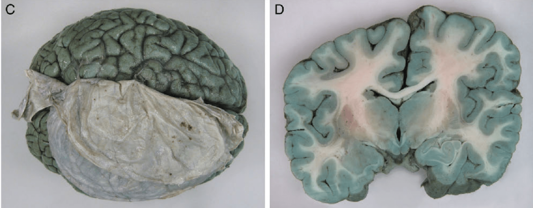 Biohacker Myths: Can Methylene Blue Truly Extend Lifespan? | № 240 ...