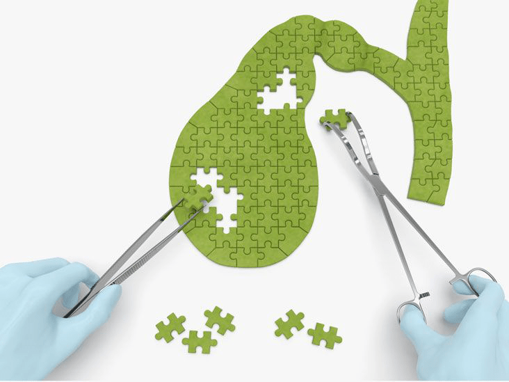 Gallbladder Radionuclide Imaging: What You Need to Know | № 6580 ...