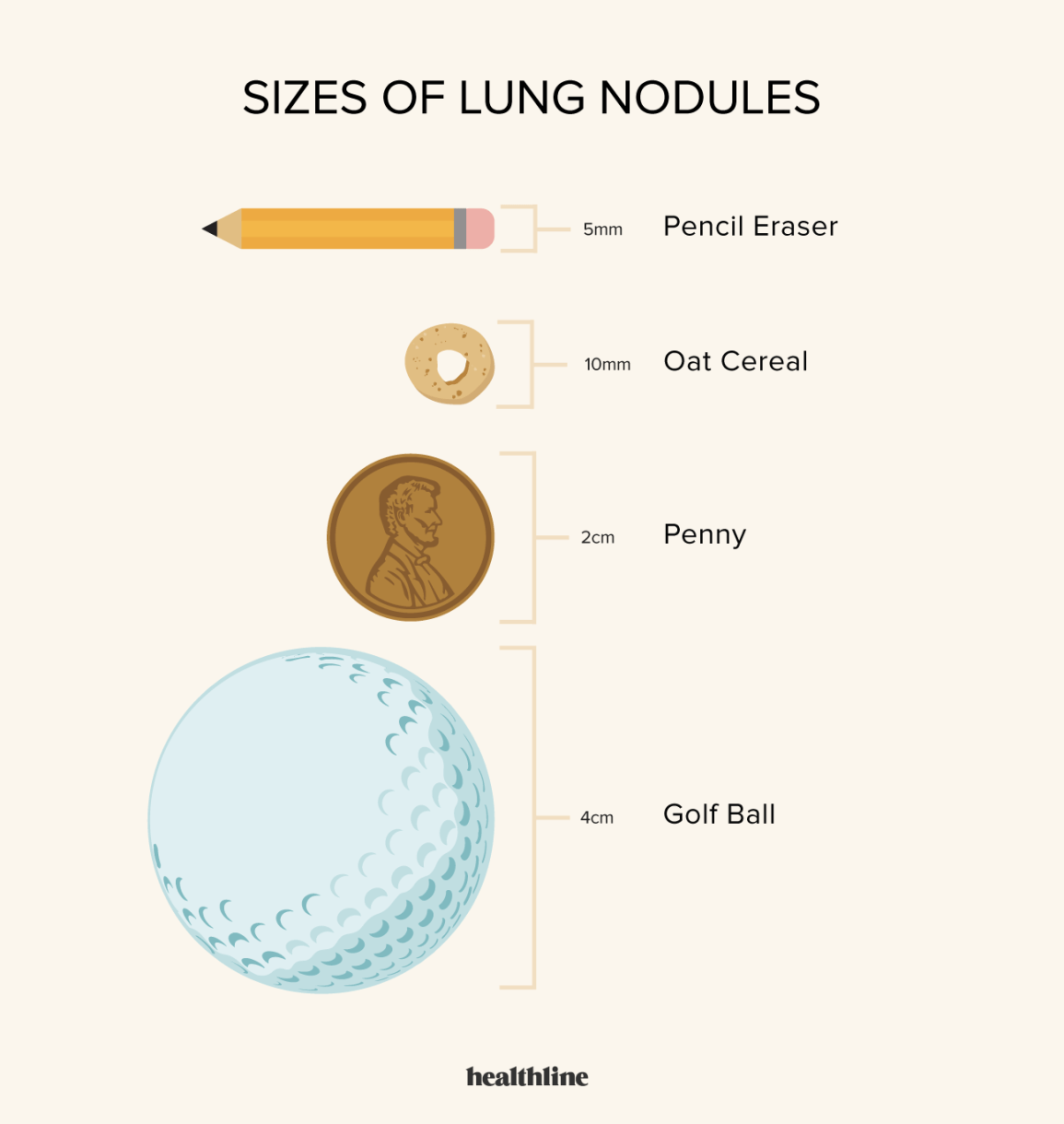 Lung Nodules in 2025: Symptoms, Causes, Diagnosis, Treatment & Costs ...