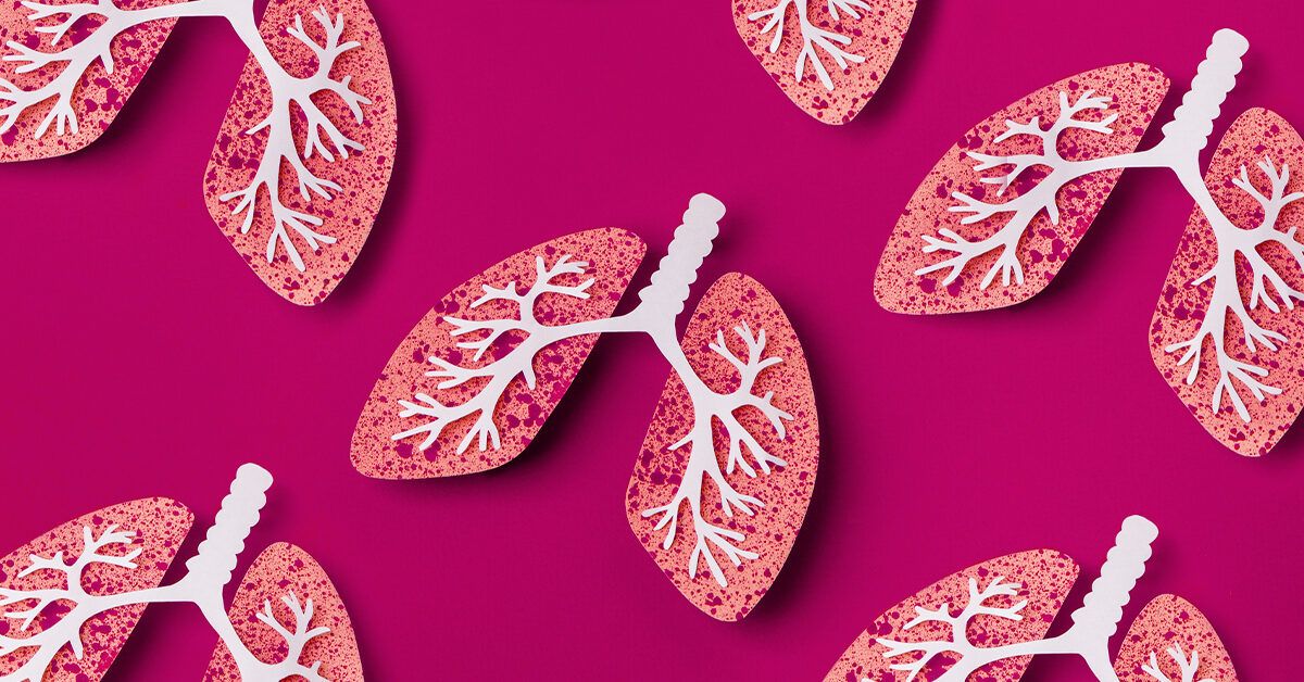 2025 Guide to Non-Small Cell Lung Cancer Types: Causes, Treatment Costs ...