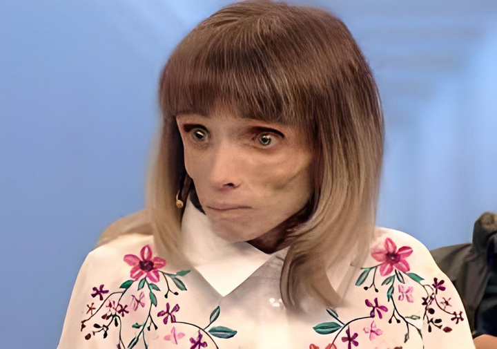 Kisah Inspiratif Kristina: Perjuangan Melawan Anoreksia dan Harapan ...