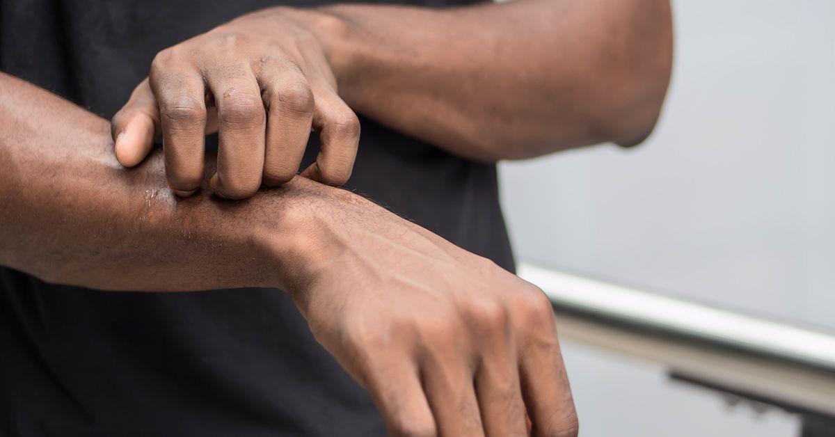 Pityriasis Rosea vs Ringworm: Key Differences, Symptoms, Causes ...